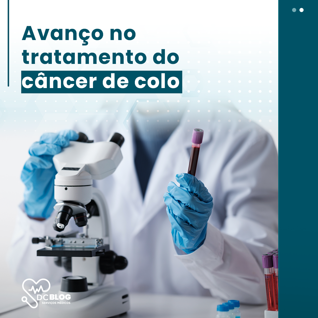 Avanço no tratamento do câncer de colo de útero - DC MED