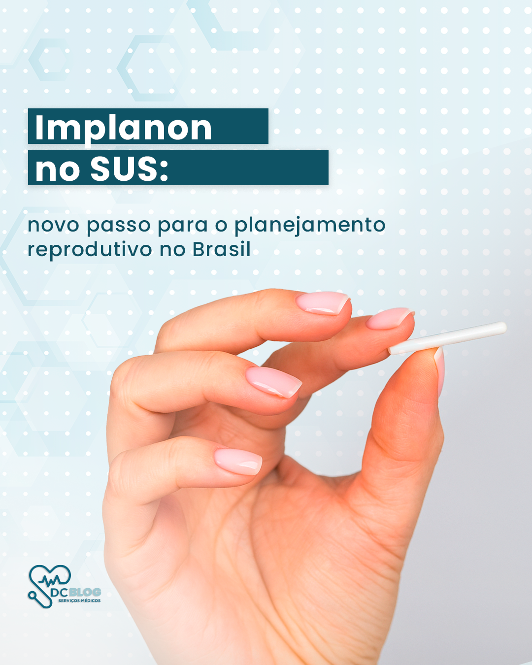 Implanon no SUS: novo passo para o planejamento reprodutivo no Brasil ...